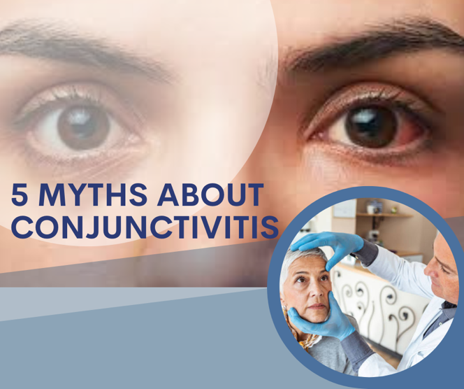 5 Myths About Conjunctivitis | Eyecare Associates of New Orleans