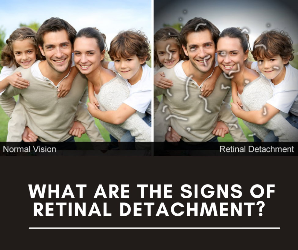 What Are The Signs Of Retinal Detachment? | Eyecare Associates of New ...